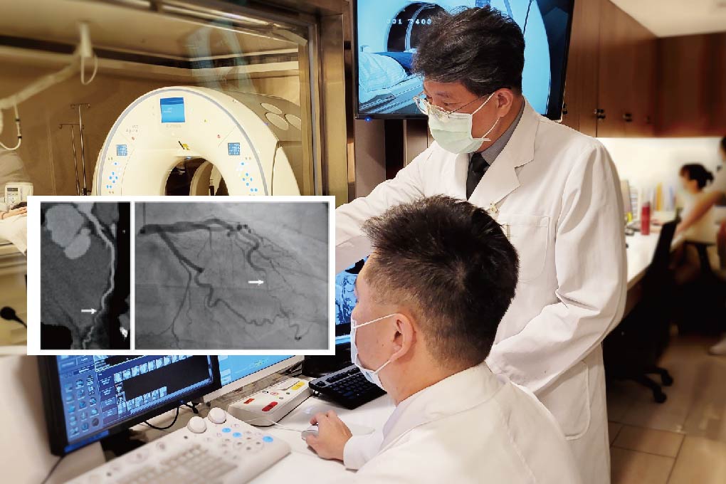 自發性冠狀動脈剝離(SCAD) — 冠狀動脈電腦斷層血管攝影檢查(CCTA)的診斷與影像特徵解析 | 西園醫療社團法人西園醫院